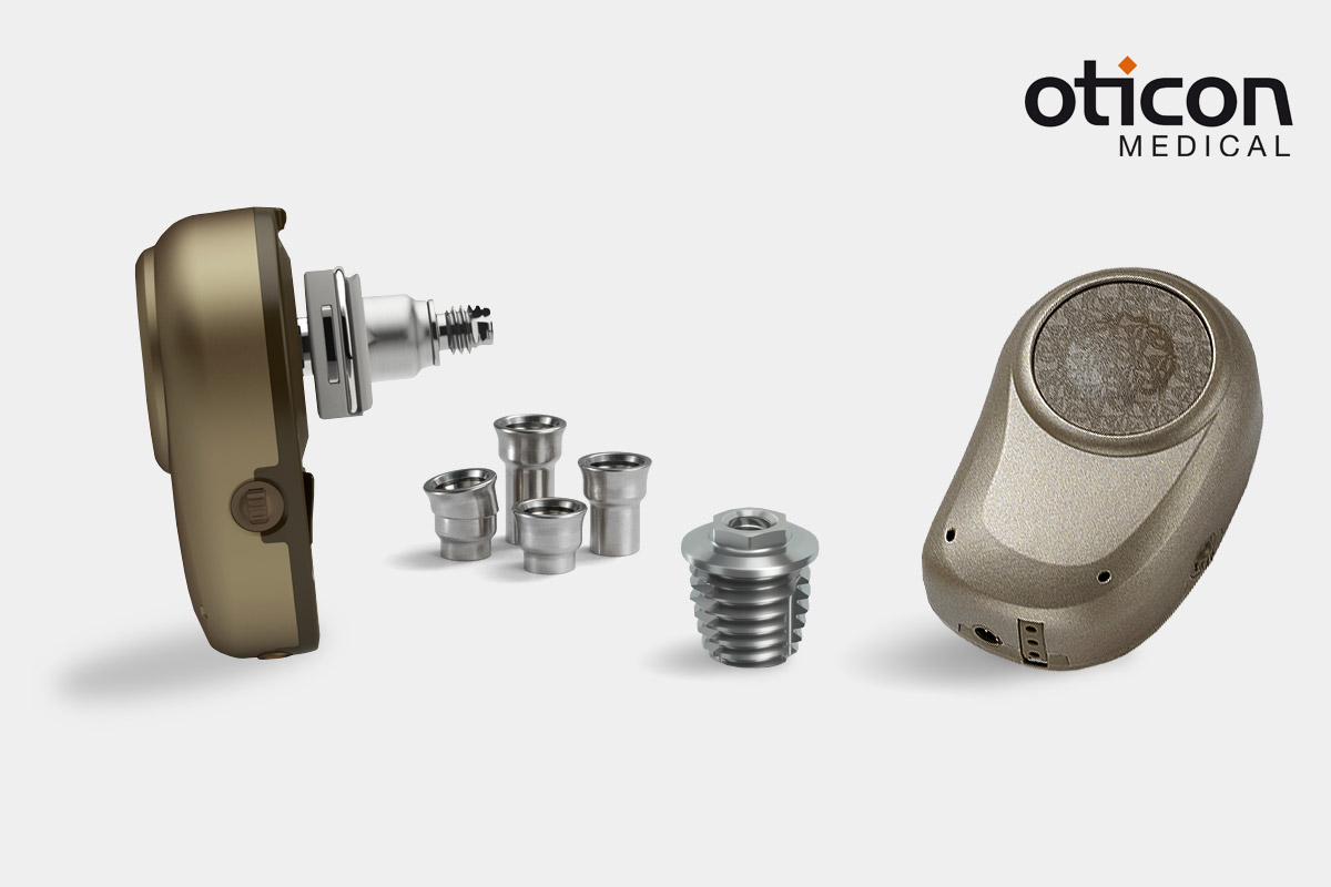 Les implants à ancrage osseux | Audioprothésiste Stéphane Rossetto