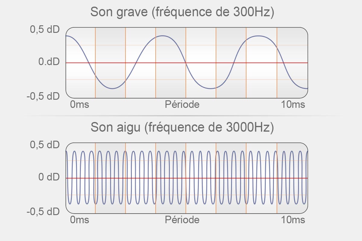 La perception du son | Audioprothésiste Stéphane Rossetto